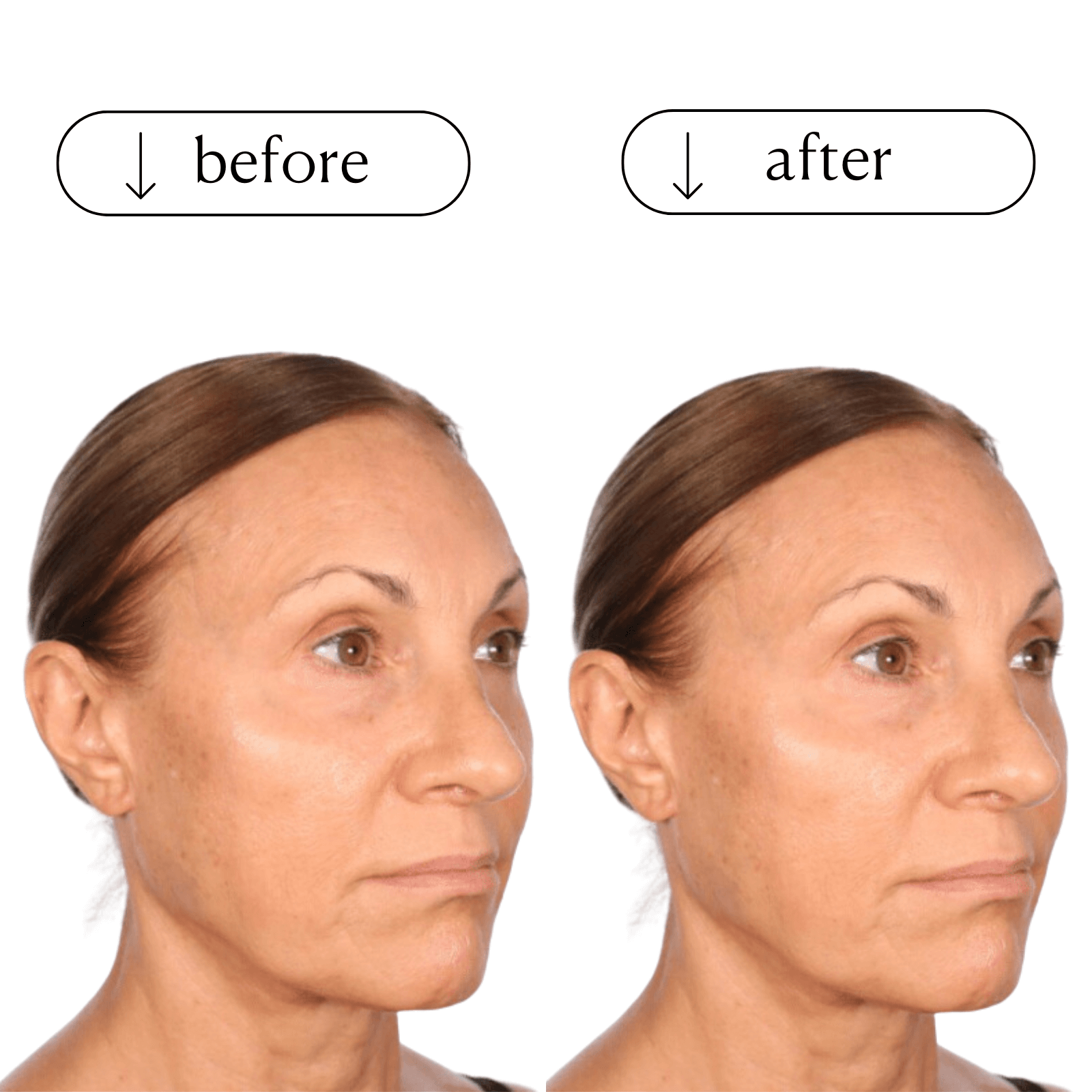 Peptide Surge Intensive Collagen Concentrate – Nakery Beauty