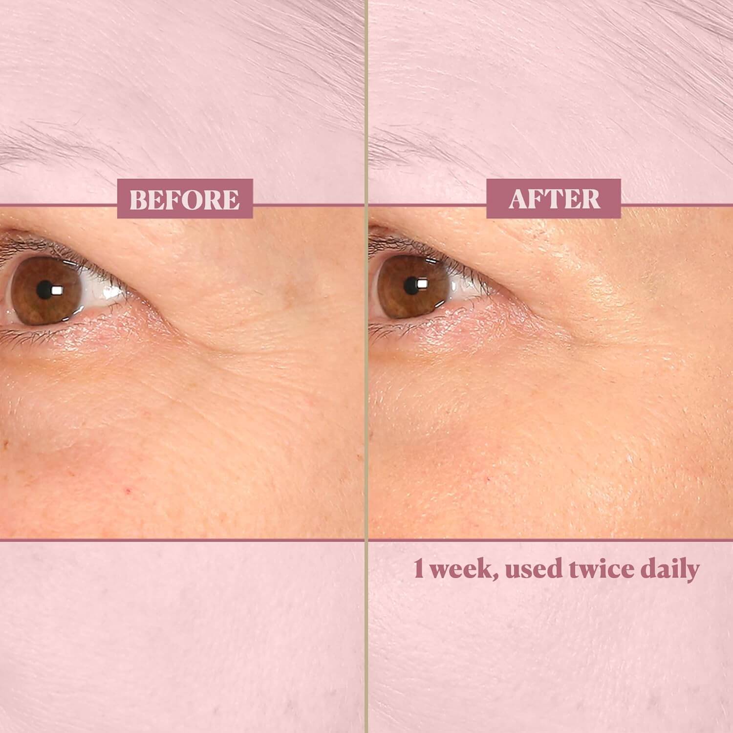 Skin Repair Double Retinol & Collagen Treatment – Revive & Restore ...