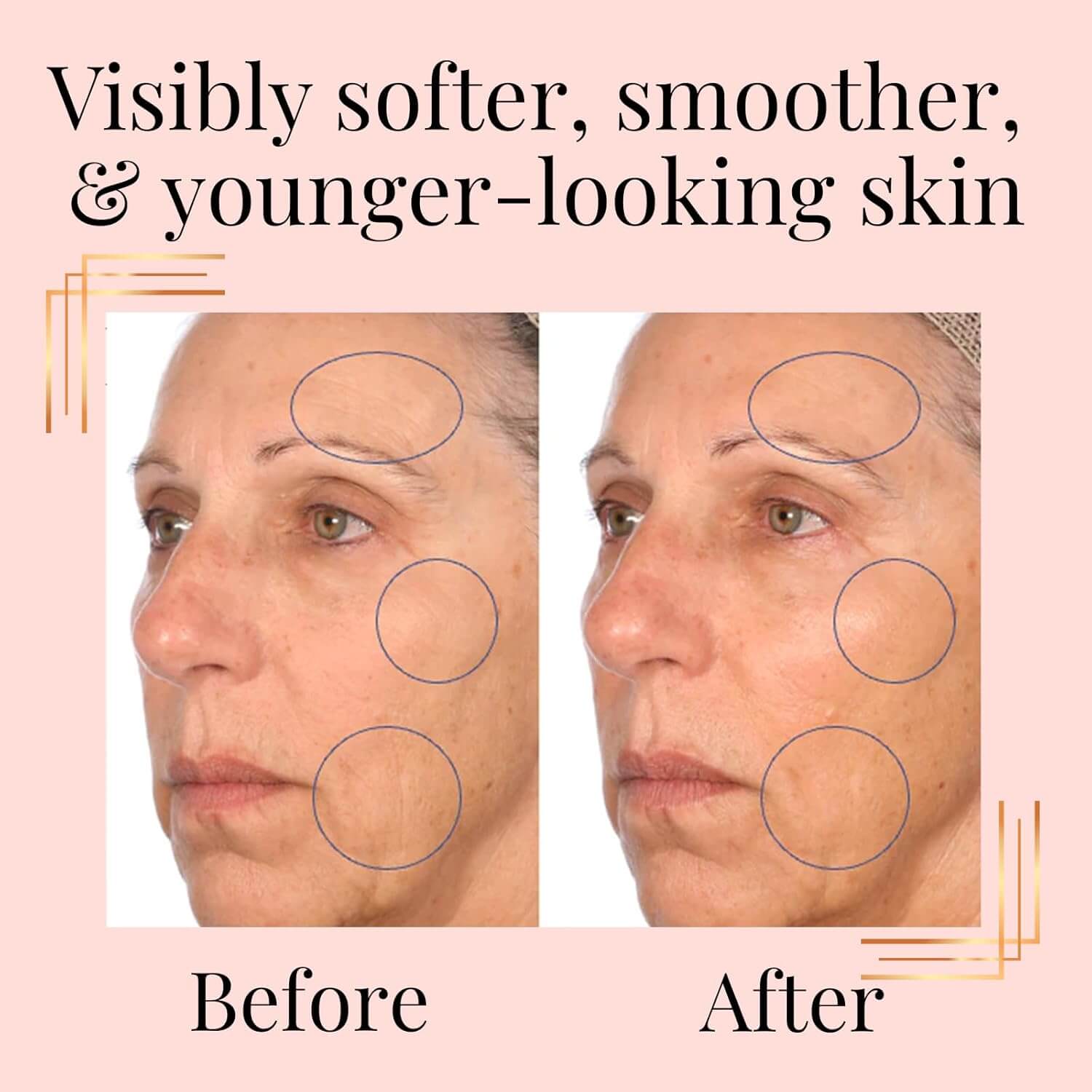 Skin Infusion Serum Oil – Nourish & Revitalize Your Skin | Nakery Beauty