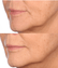 Skin Repair Double Retinol & Collagen Treatment – Revive & Restore ...